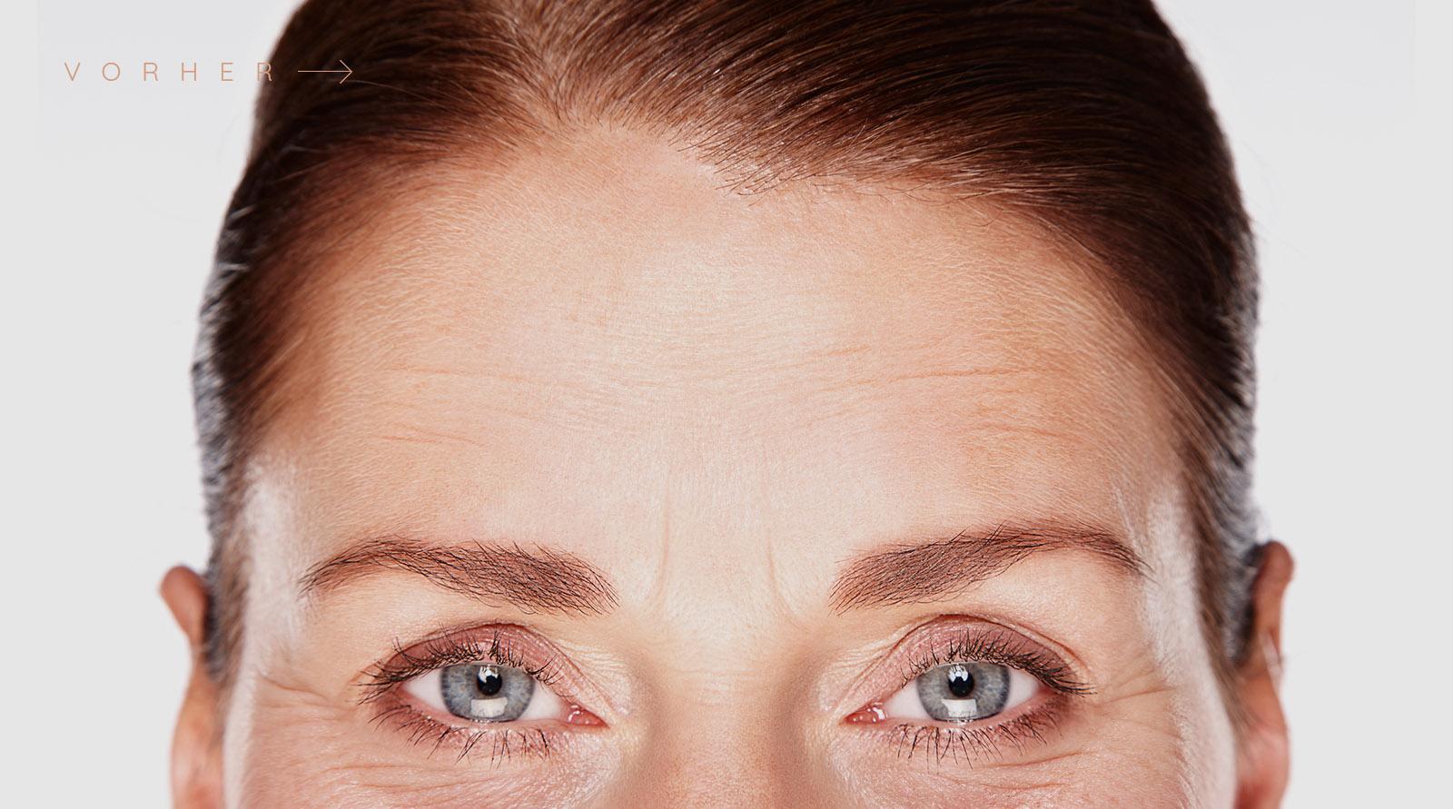 lr12_Dermalstyle_EN | W&O medical esthetics GmbH